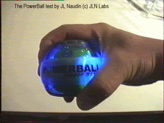 Tennis Elbow. Any Cures? - NASIOC